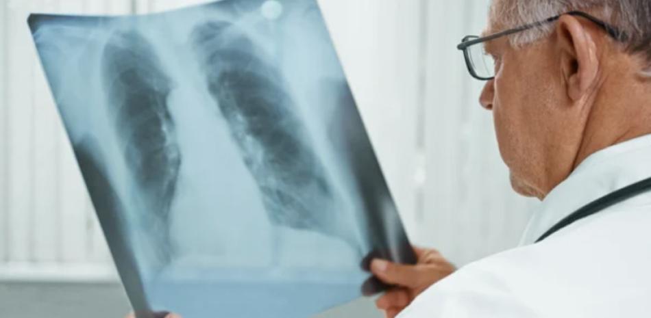 Los casos de niños con tuberculosis en República Dominicana y el ...
