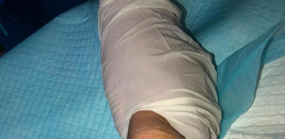 Madre lanza recaudación de fondos para su bebé con celulitis y absceso ...