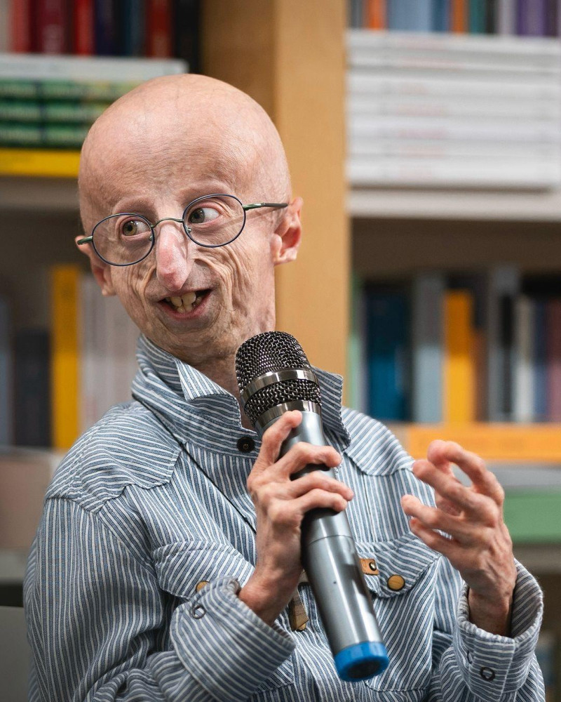Así es envejecer con progeria, el síndrome que padecía el afamado ...
