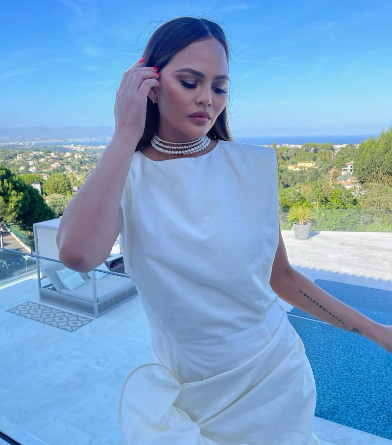 Chrissy Teigen se somete a un procedimiento en la línea del cabello ...