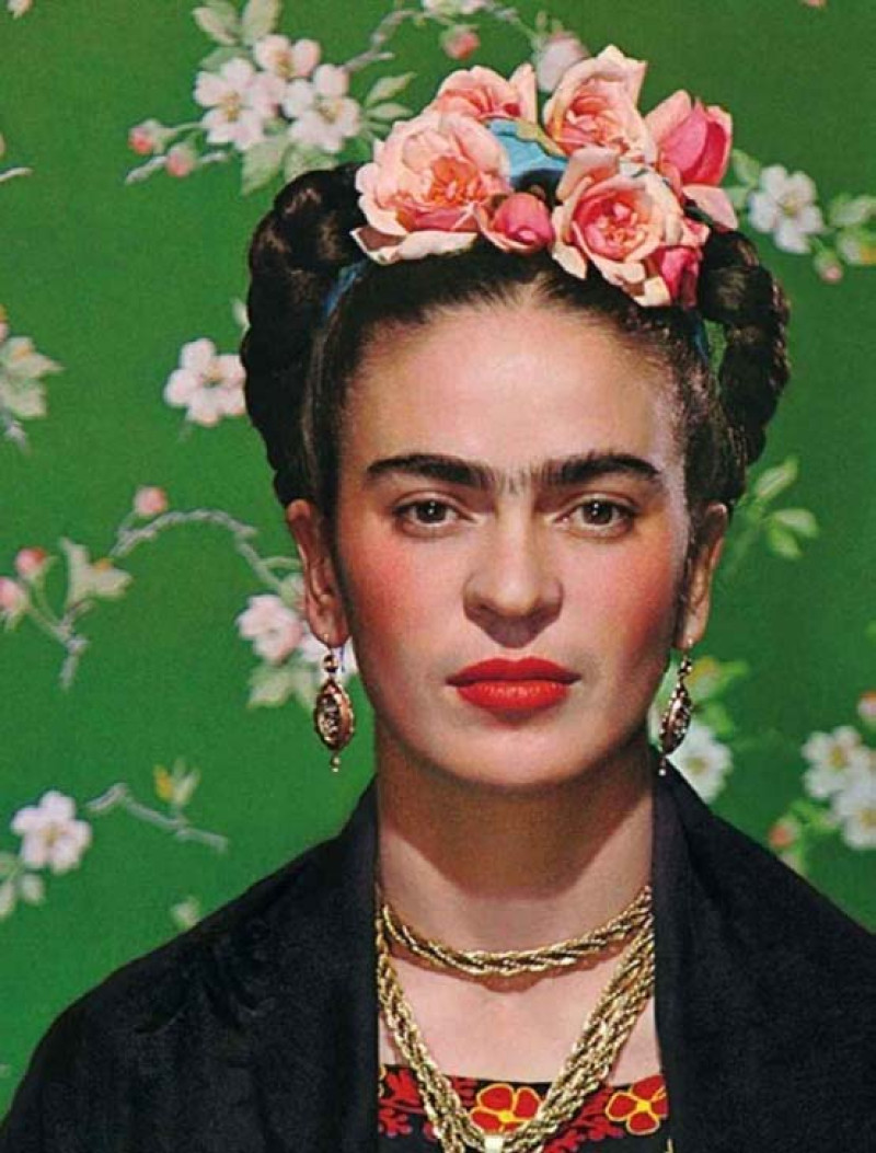 Frida Kahlo diagnosticada con síndrome de cola de caballo, 70 años después